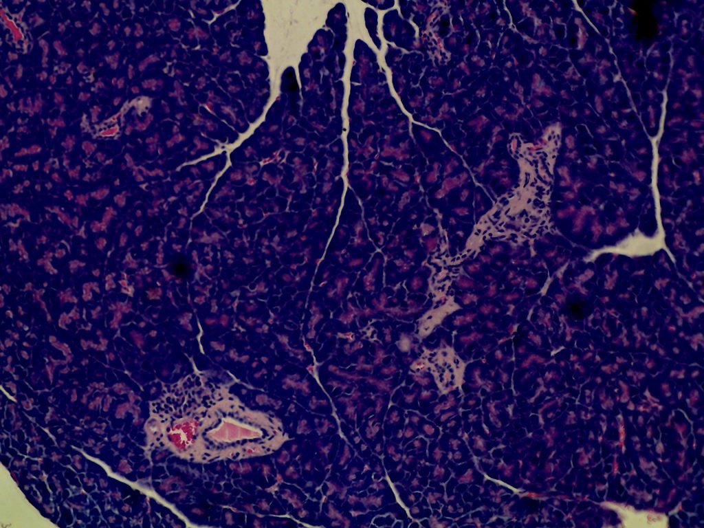Mouse 24 Pancreas – Mouse Model of Type 1 Diabetes Atlas