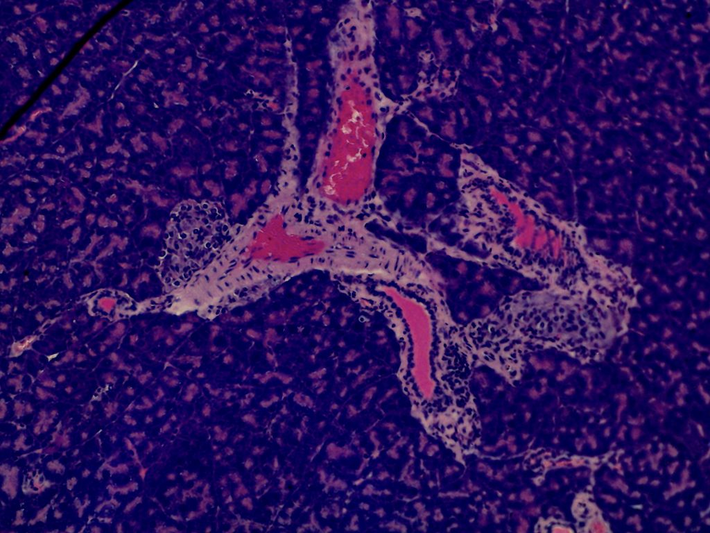Mouse 25 Pancreas – Mouse Model of Type 1 Diabetes Atlas