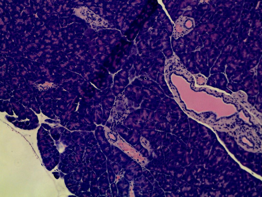 Mouse 25 Pancreas – Mouse Model of Type 1 Diabetes Atlas
