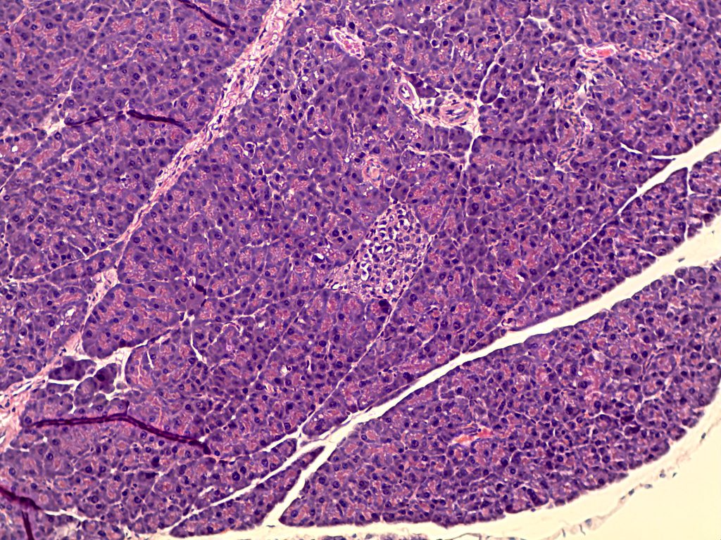 Mouse 13 Pancreas – Mouse Model of Type 1 Diabetes Atlas