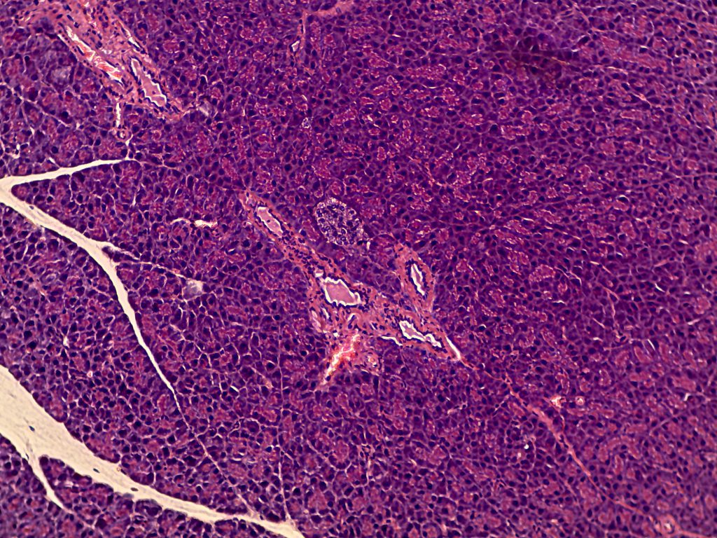 Mouse 27 Pancreas – Mouse Model of Type 1 Diabetes Atlas