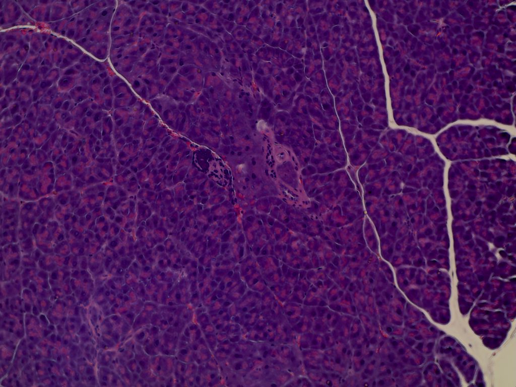 Mouse 15 Pancreas – Mouse Model of Type 1 Diabetes Atlas