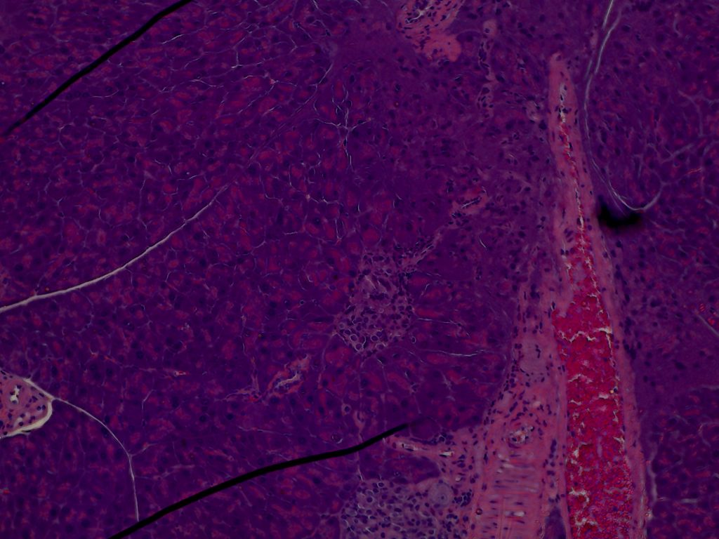 Mouse 15 Pancreas – Mouse Model of Type 1 Diabetes Atlas