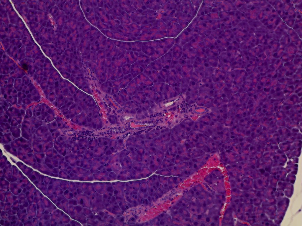 Mouse 15 Pancreas – Mouse Model of Type 1 Diabetes Atlas