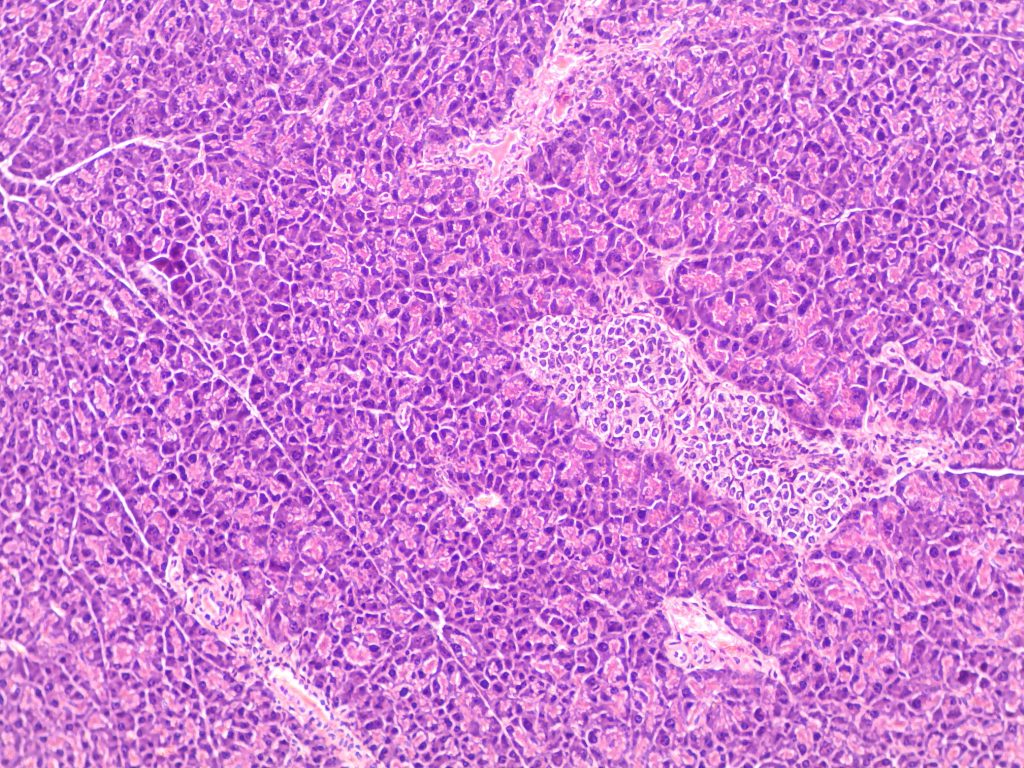 Mouse 24 Pancreas – Mouse Model of Type 1 Diabetes Atlas