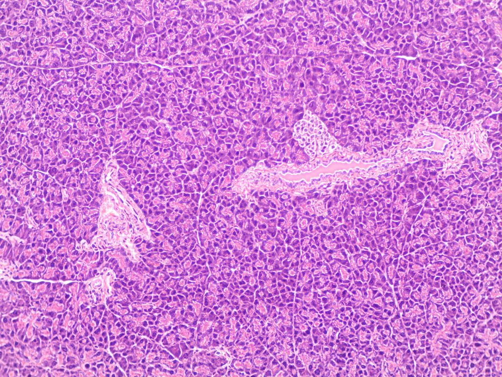 Mouse 24 Pancreas – Mouse Model of Type 1 Diabetes Atlas