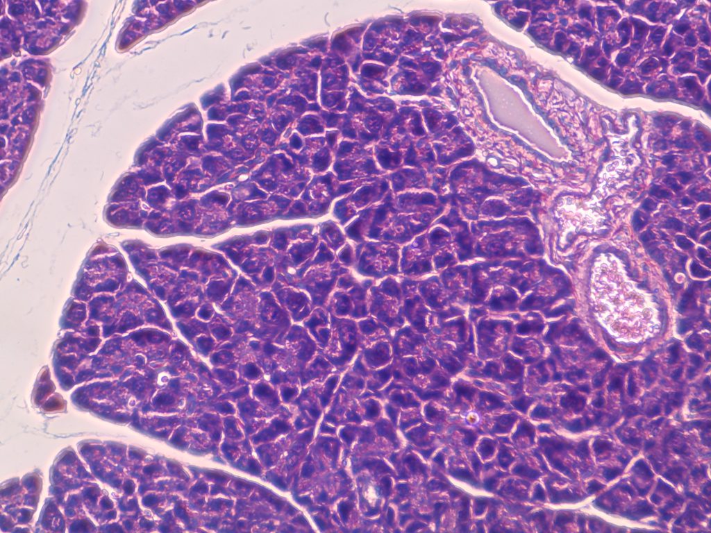 Mouse 17 Pancreas – Mouse Model of Type 1 Diabetes Atlas