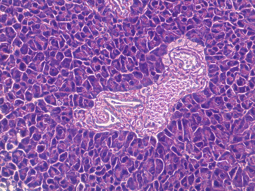 Mouse 20 Pancreas – Mouse Model of Type 1 Diabetes Atlas