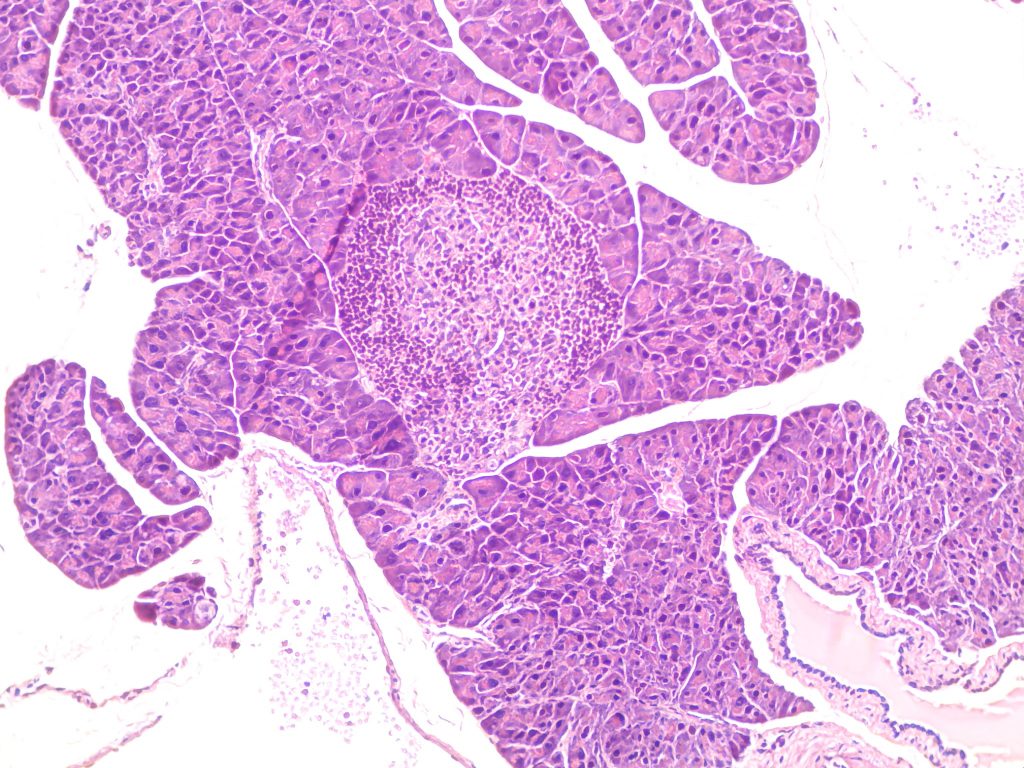 Mouse 20 Pancreas – Mouse Model of Type 1 Diabetes Atlas