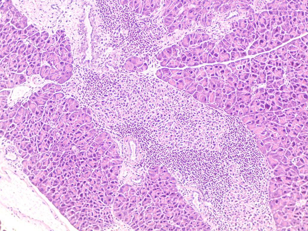 Mouse 20 Pancreas – Mouse Model of Type 1 Diabetes Atlas