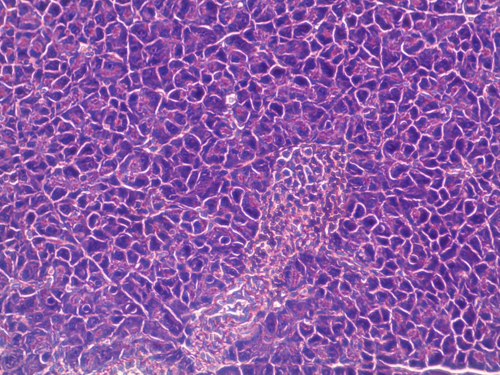 Mouse 20 Pancreas – Mouse Model of Type 1 Diabetes Atlas