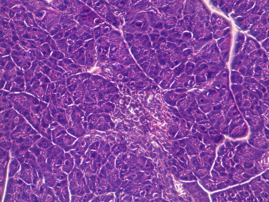 Mouse 6 Pancreas – Mouse Model of Type 1 Diabetes Atlas