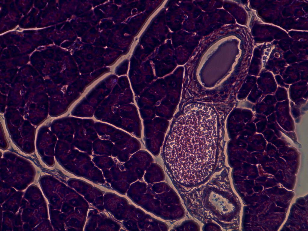 Mouse 19 Pancreas – Mouse Model of Type 1 Diabetes Atlas