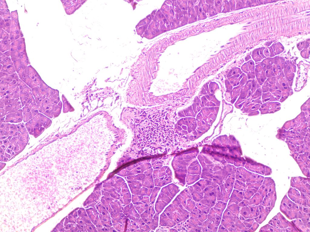 Mouse 19 Pancreas – Mouse Model of Type 1 Diabetes Atlas