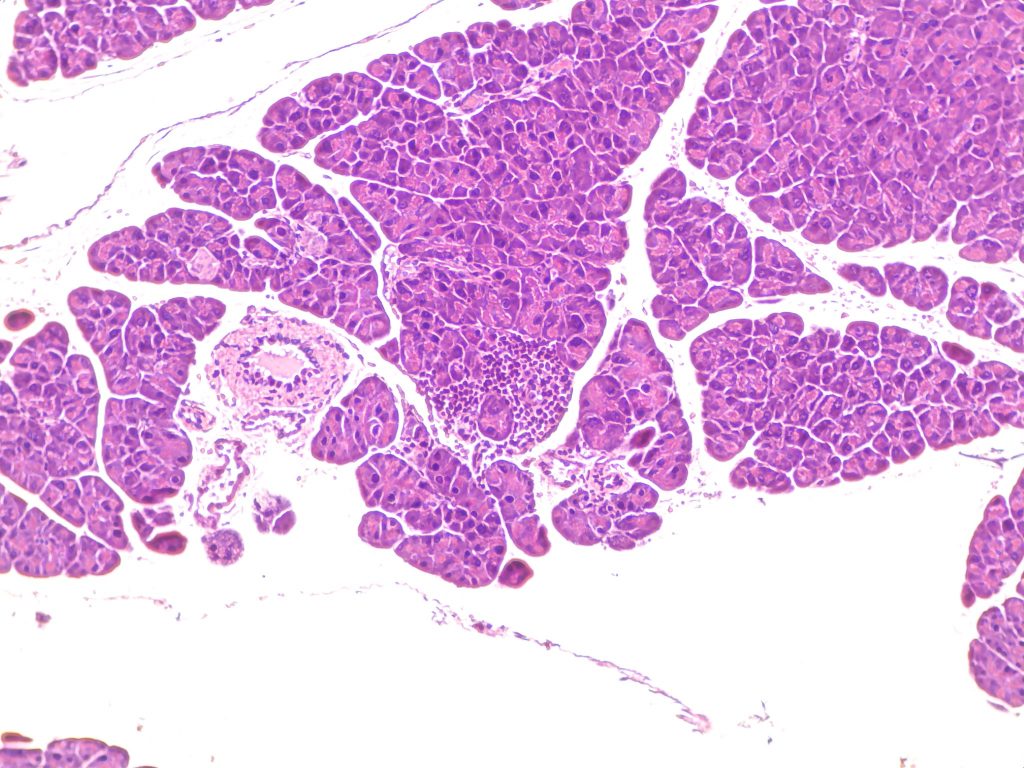 Mouse 20 Pancreas – Mouse Model of Type 1 Diabetes Atlas