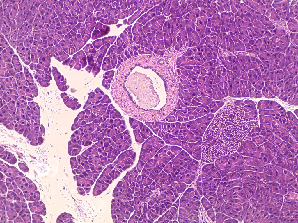 Mouse 20 Pancreas – Mouse Model of Type 1 Diabetes Atlas