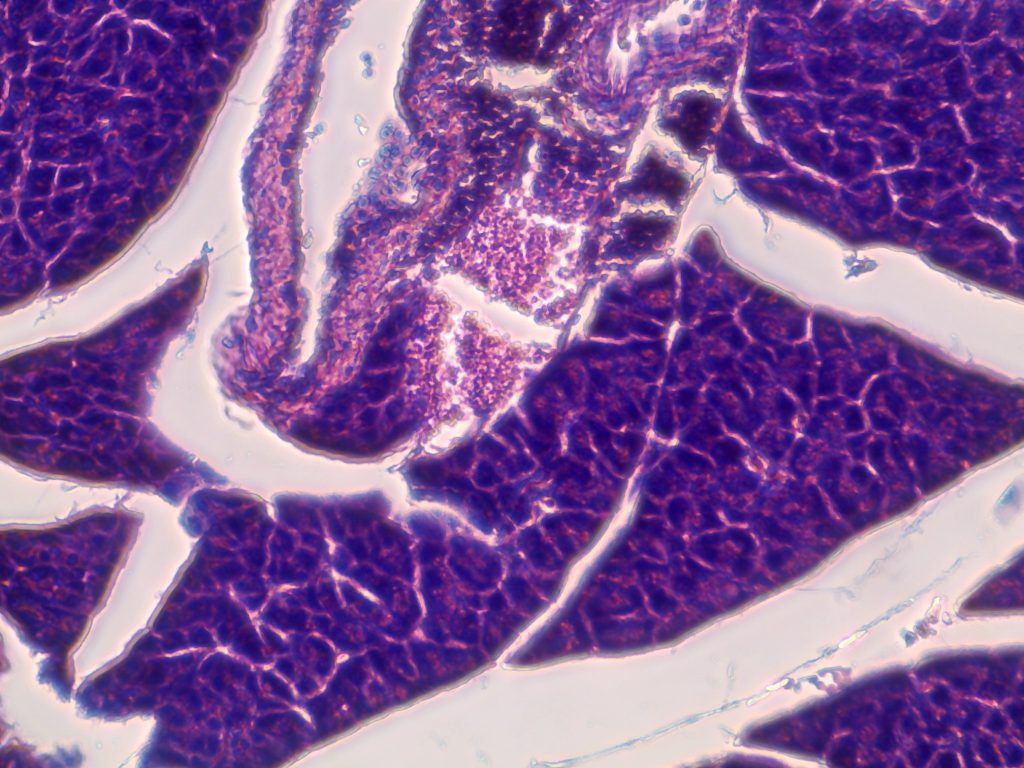 Mouse 4 Pancreas – Mouse Model of Type 1 Diabetes Atlas