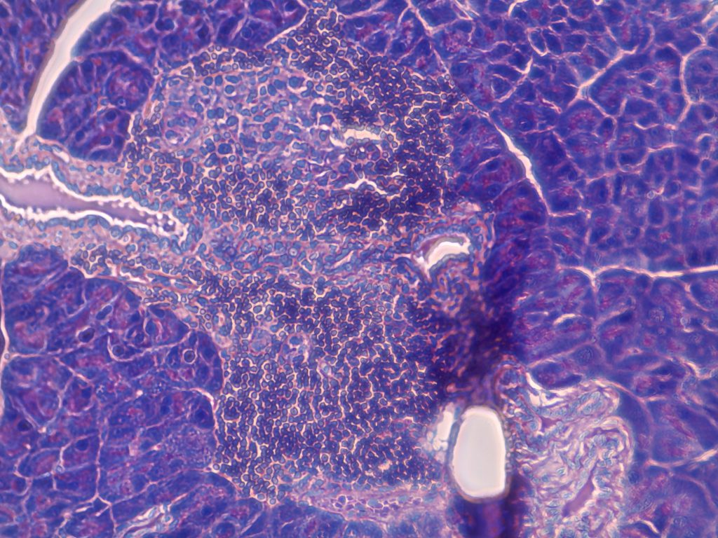 Mouse 32 Pancreas NOD B – Mouse Model of Type 1 Diabetes Atlas