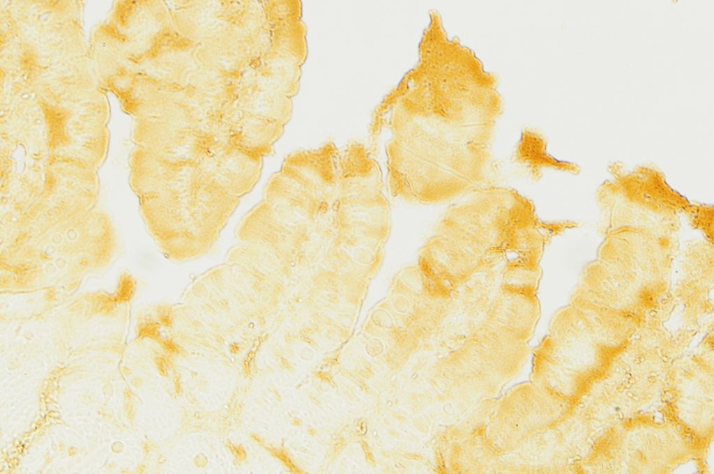 Control 5 Duodenum – Mouse Model of Type 1 Diabetes Atlas