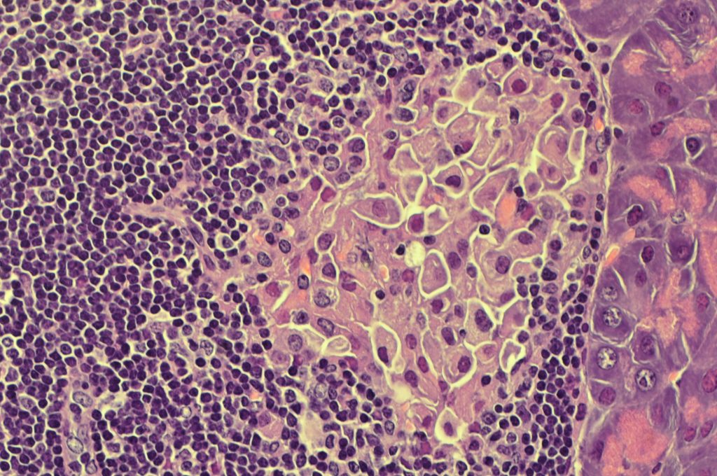 Pancreas – Mouse Model of Type 1 Diabetes Atlas