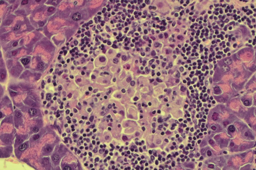 Pancreas – Mouse Model of Type 1 Diabetes Atlas
