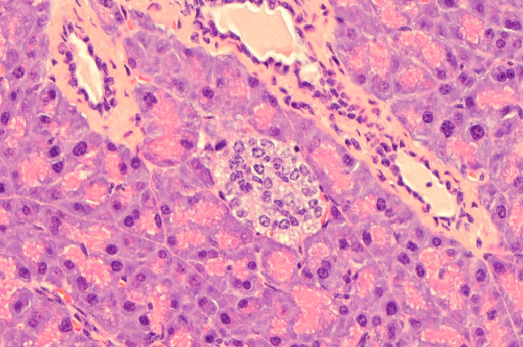 Pancreas – Mouse Model of Type 1 Diabetes Atlas